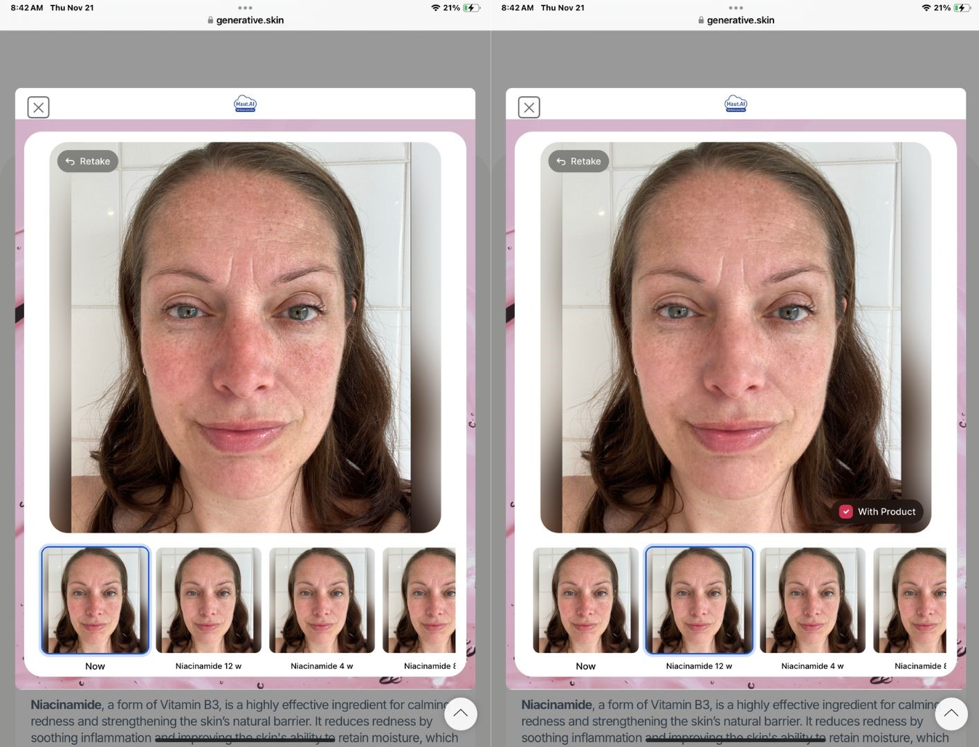 Haut.AI’s SkinGPT and Interactive 'Generative Skin' Technology + Q&A ...